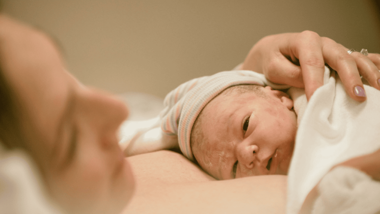 Bebê Empelicado - Entenda sobre esse raro fenômeno - Mamae Iniciante